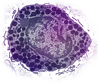 How to Obtain a Mast Cell Activation Diagnosis | AllergicChild